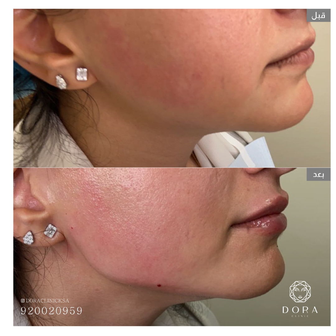 Dr. Azza Hussein | Dora Clinics